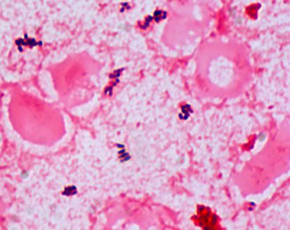 Schaalia odontolytica / Actinomyces odontolyticus