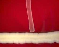 CAMP-test revers_Arcanobacterium haemolyticum