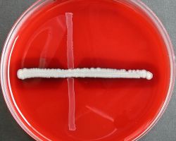 CAMP-test revers_Arcanobacterium haemolyticum